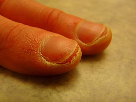 "Asiakkailla on joskus hankaluuksia ymmärtää, että on liian kylmä ...